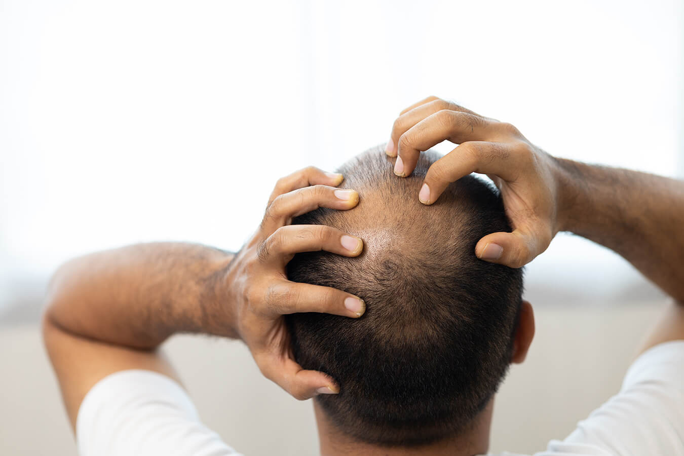 Perdita di capelli: cause e rimedi naturali efficaci - La Palestra